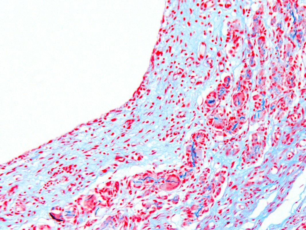 Medical Device Specialized Histology