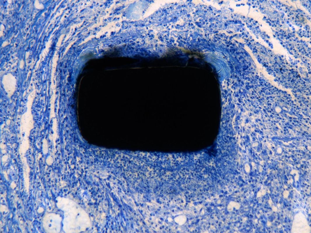 Medical Device Specialized Histology