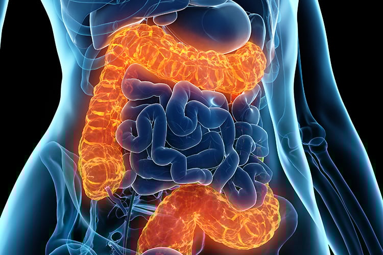 Applying Quantitative Proteomics for Target System Analysis in ...