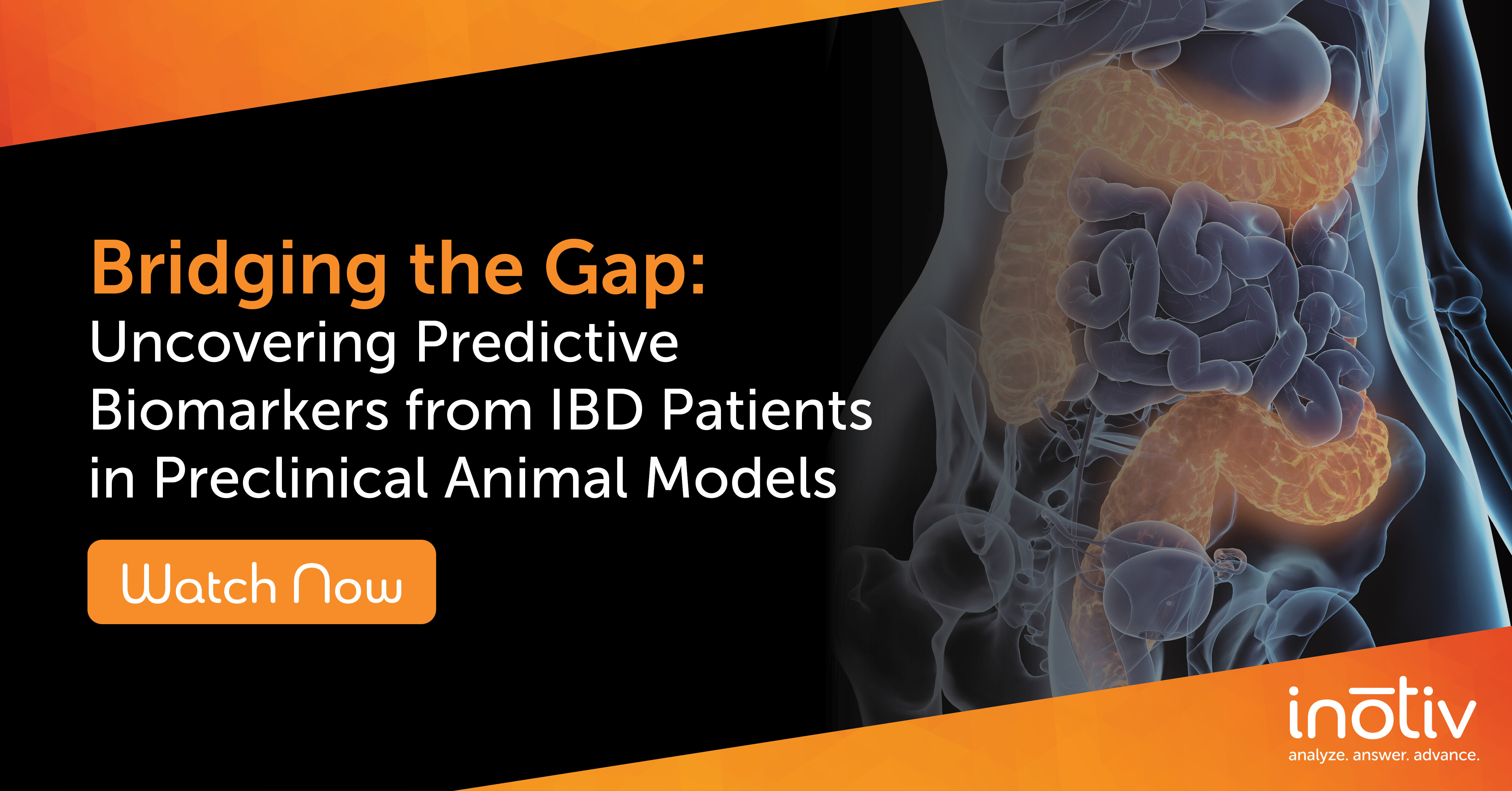 Webinar—Advanced Methods for Uncovering IBD Biomarkers