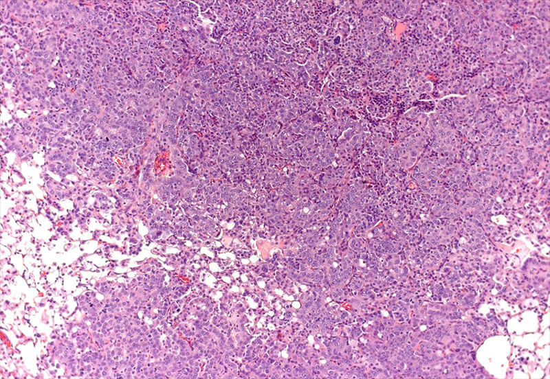 Pathological review of genetically modified mouse lung tissue